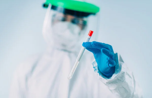 COVID-19 PCR Test: Overview, Accuracy & Testing Guide 2022 | AIMS ...